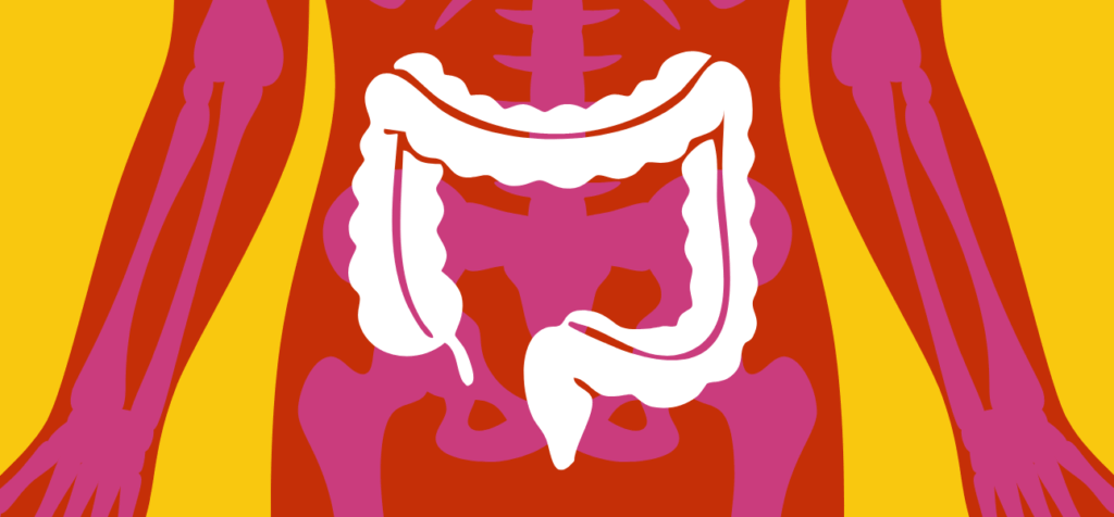 Ulcerative Colitis – taXonomy Pathways